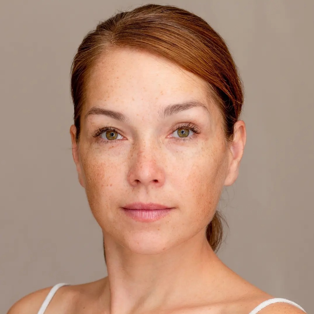 Best Sculptra® Houston, & The Woodlands, TX | myEvergreen MedSpa